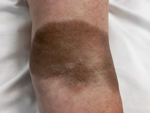 Conditions - Laser Skin Care